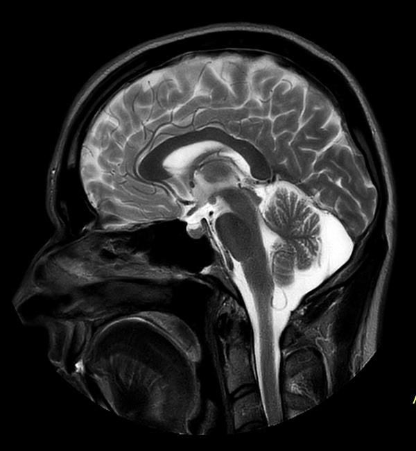 Comprehensive Brain Imaging At 1 5t Philips Mr Body Map