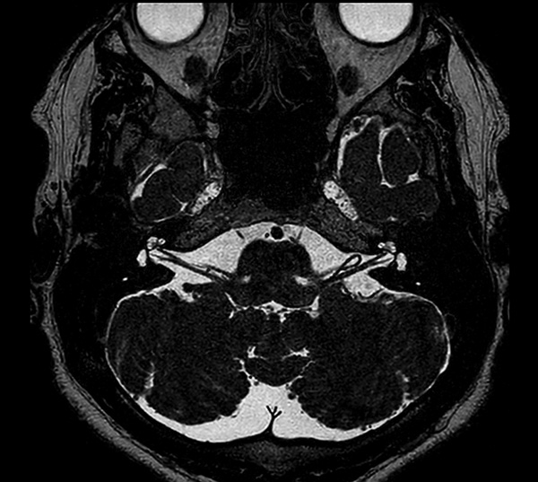Comprehensive Brain Imaging At 1 5t Philips Mr Body Map