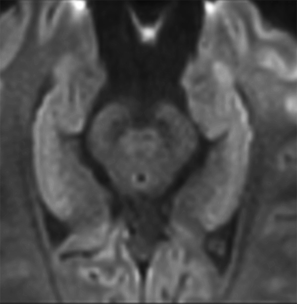 Comprehensive Brain Imaging At 3 0t Philips Mr Body Map