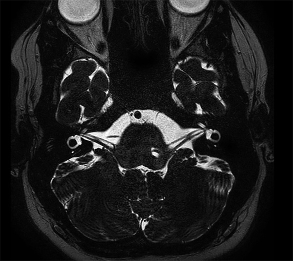 Comprehensive Brain Imaging At 3 0t Philips Mr Body Map