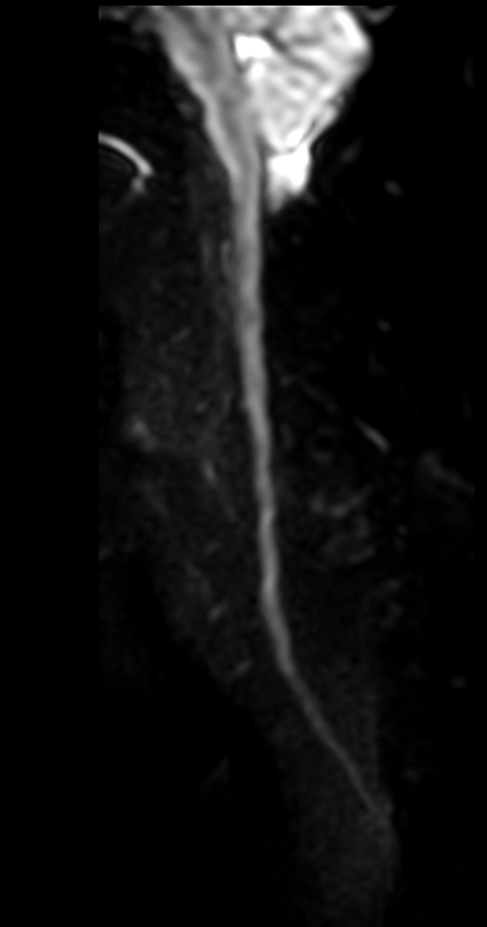 Comprehensive Cervical Spine Imaging At 3 0t Philips Mr Body Map