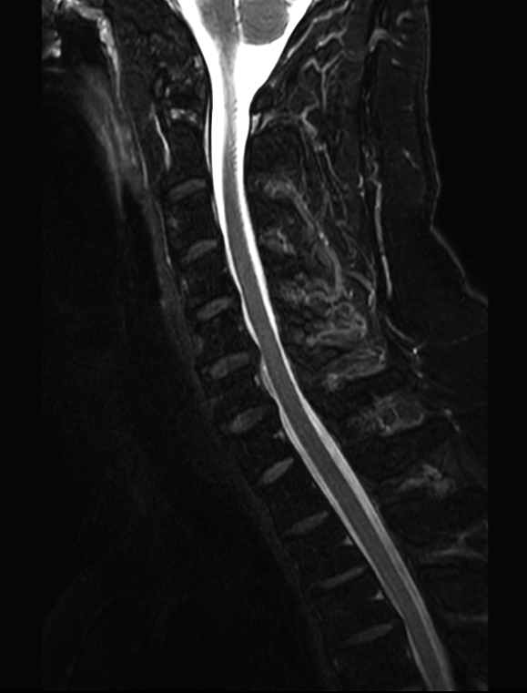 Comprehensive Cervical Spine Imaging At 3 0t Philips Mr Body Map