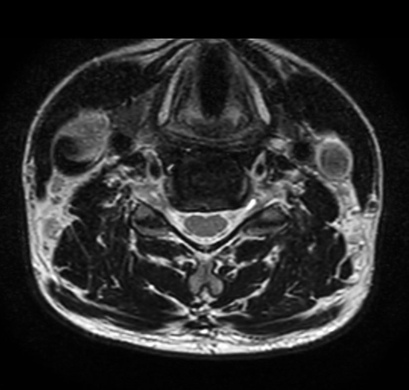 Cervical Spine Imaging With Mdixon Tse Philips Mr Body Map