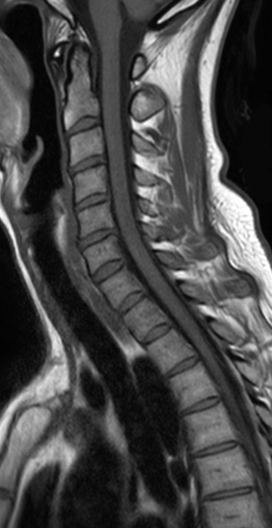 Cervical Spine With Acoustic Noise Reduction Philips Mr Body Map